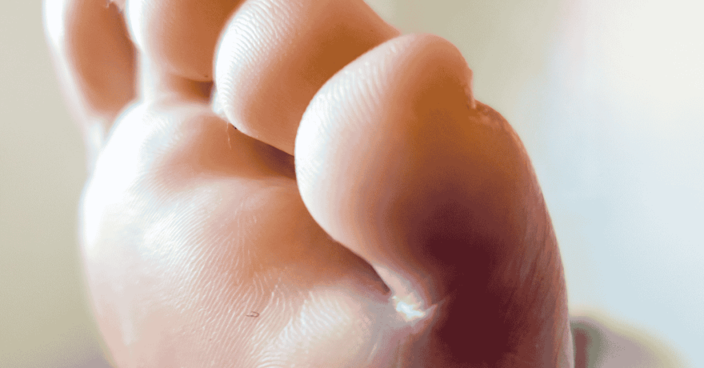 To Walk or Not to Walk: Navigating Life with a Fractured Toe - Bellagio ...